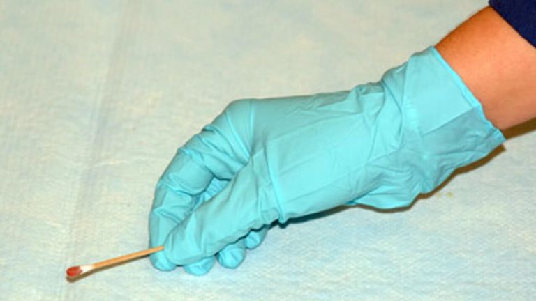 What Does Dried Blood Look Like